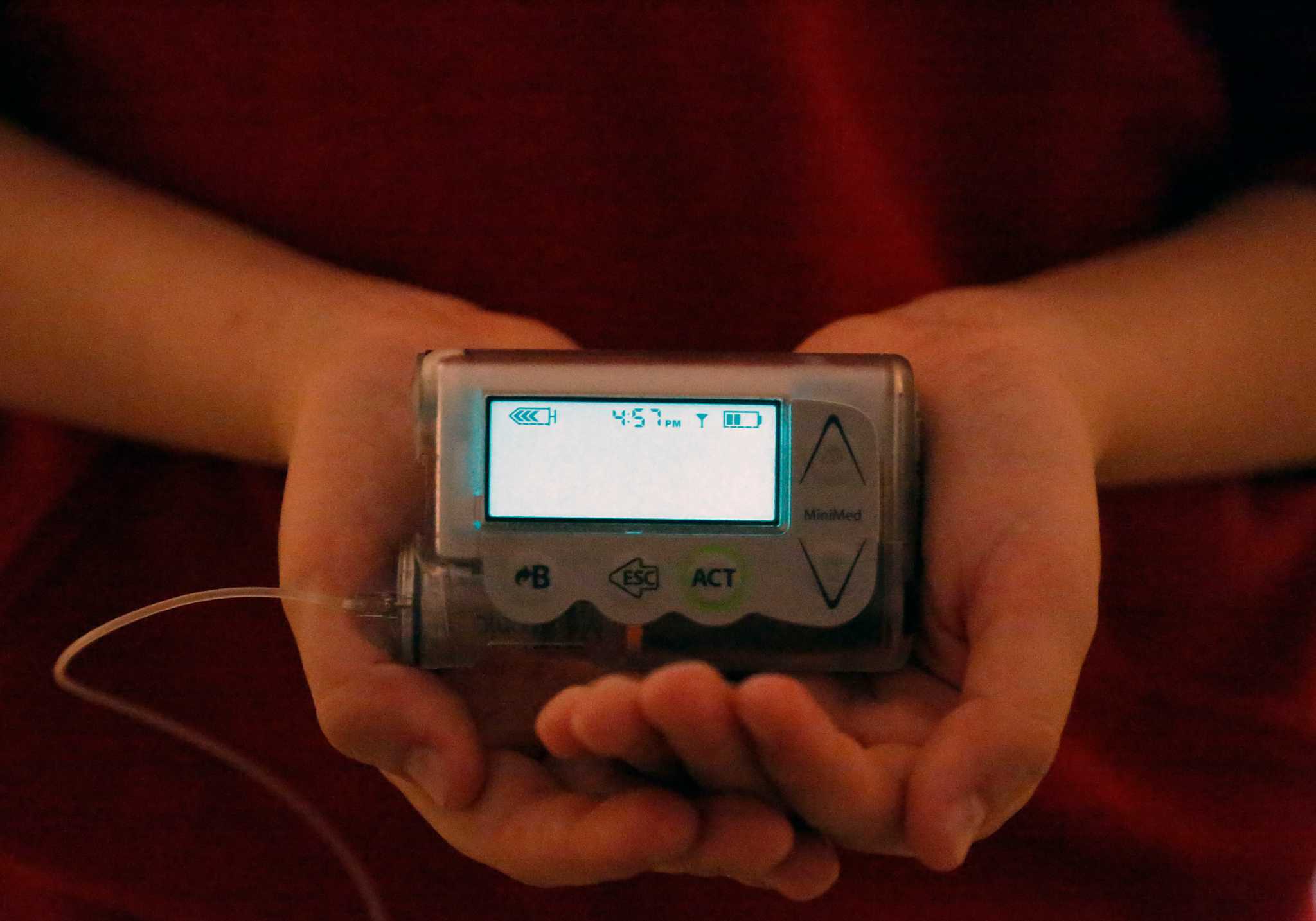 New diabetic device a step on the way to artificial pancreas