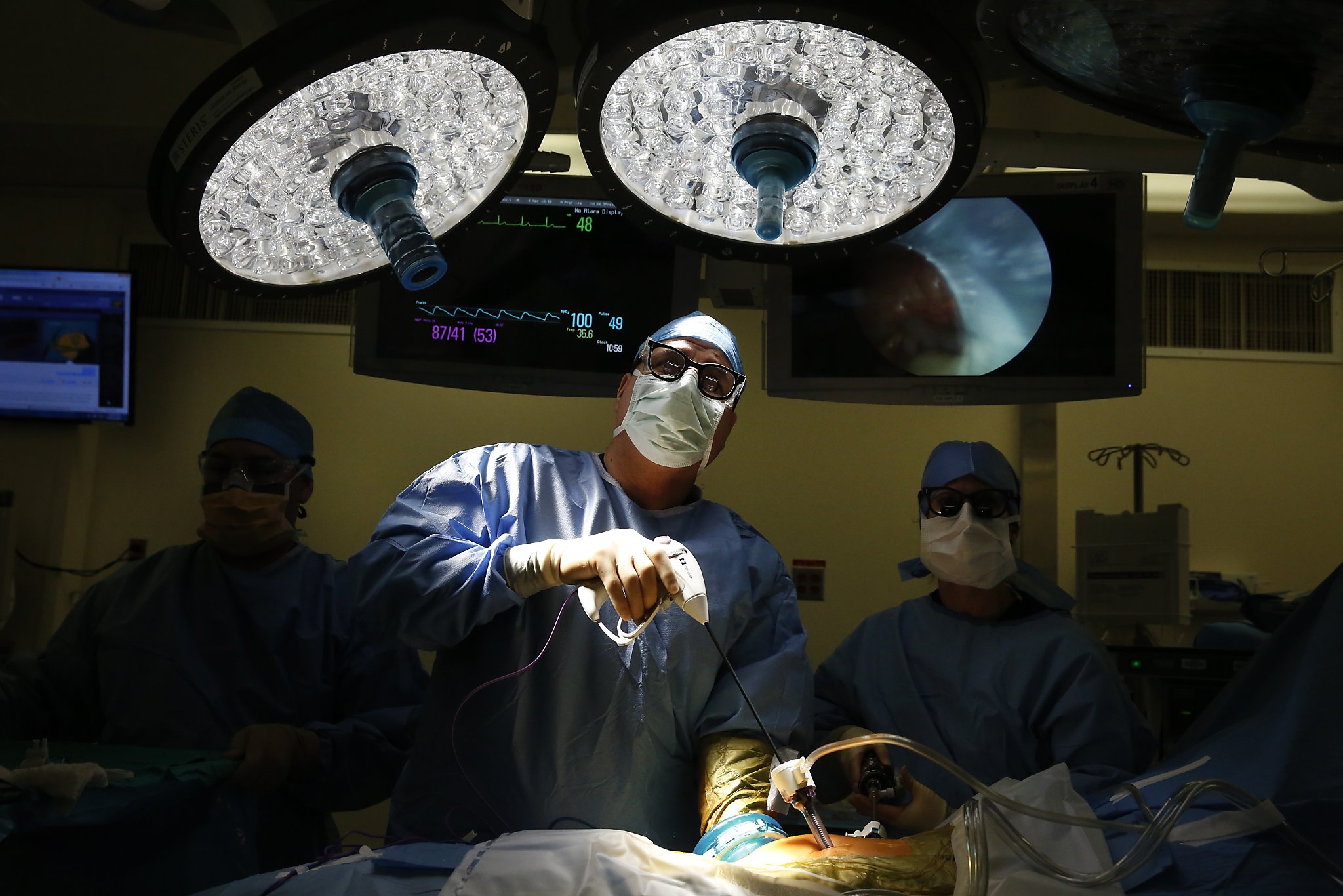 3 transplants in rare 6-way kidney swap completed in S.F.