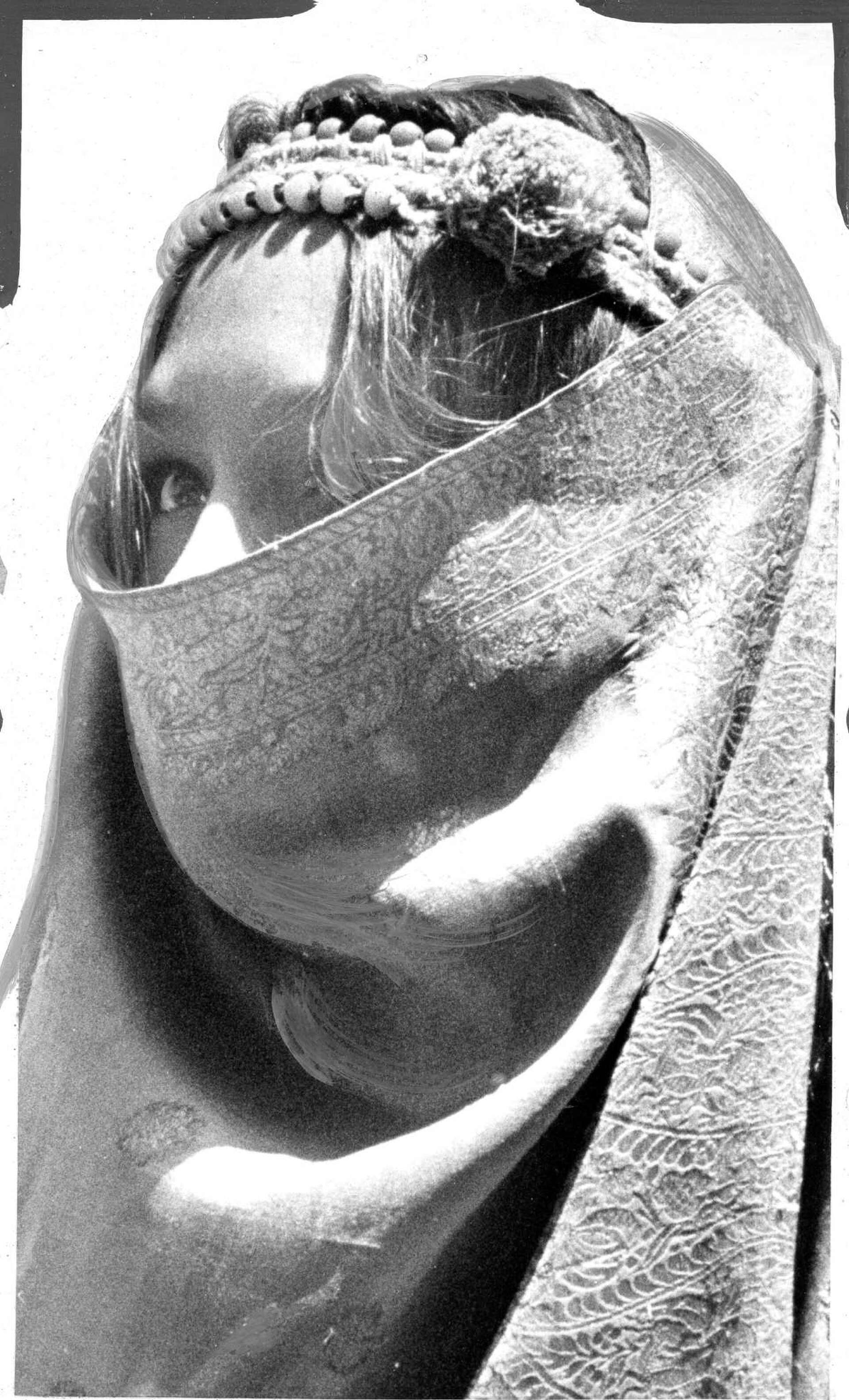 From the Archive: Behind the bandage