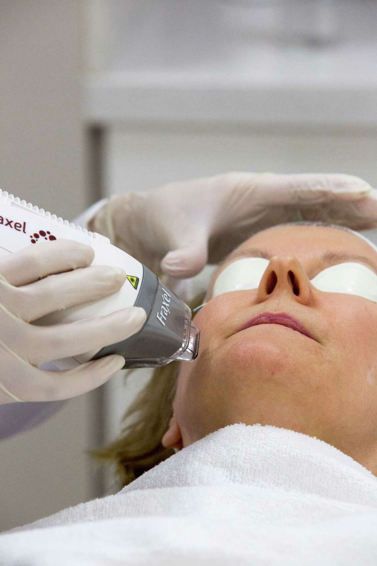 Fraxel laser can improve skin in 20 very hot minutes