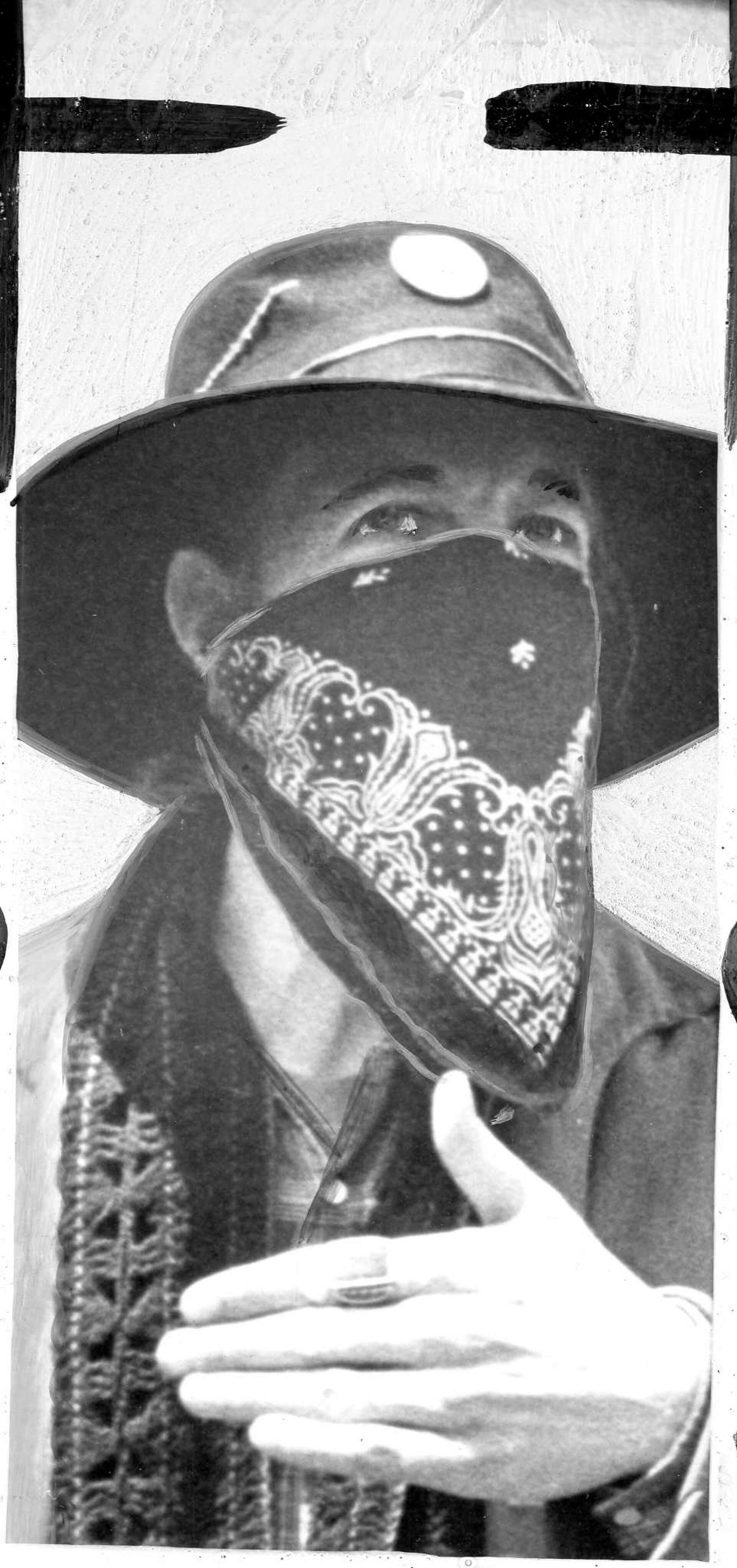 From the Archive: Behind the bandage