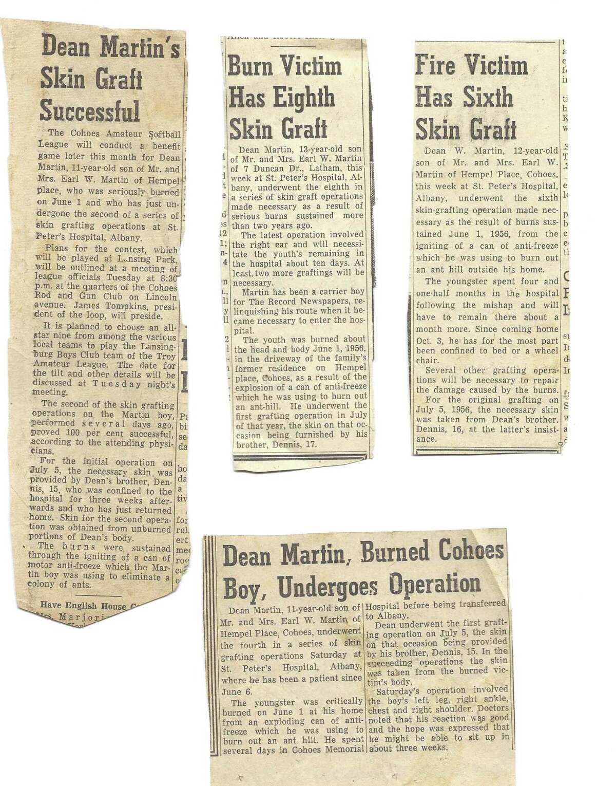 Living with humor after childhood fire tragedy