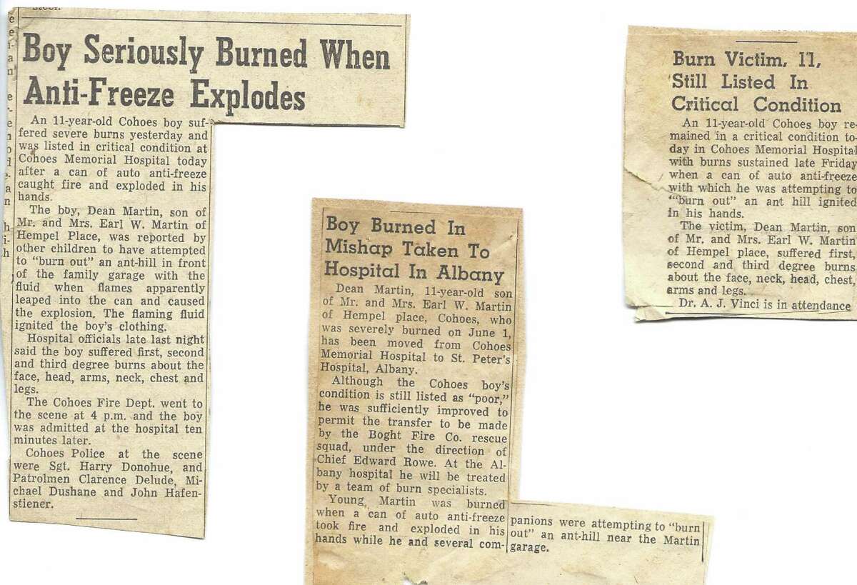 Living with humor after childhood fire tragedy