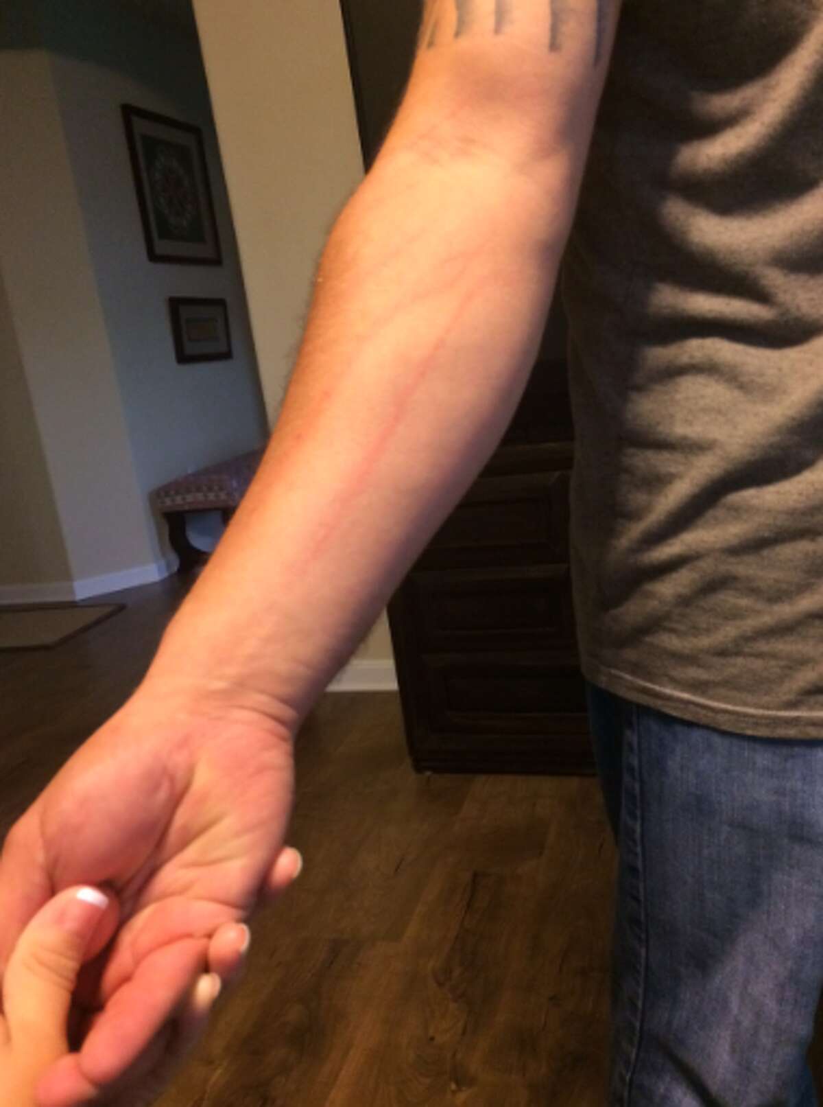 Central Texas teen has sense of humor as she recovers from being struck ...