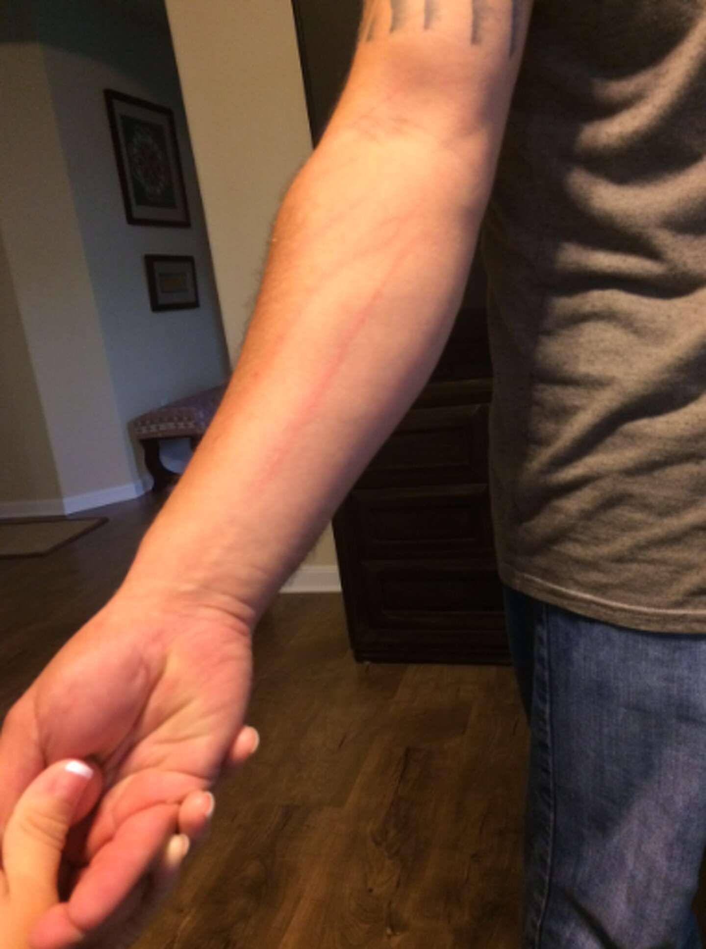 Central Texas teen has sense of humor as she recovers from being struck ...