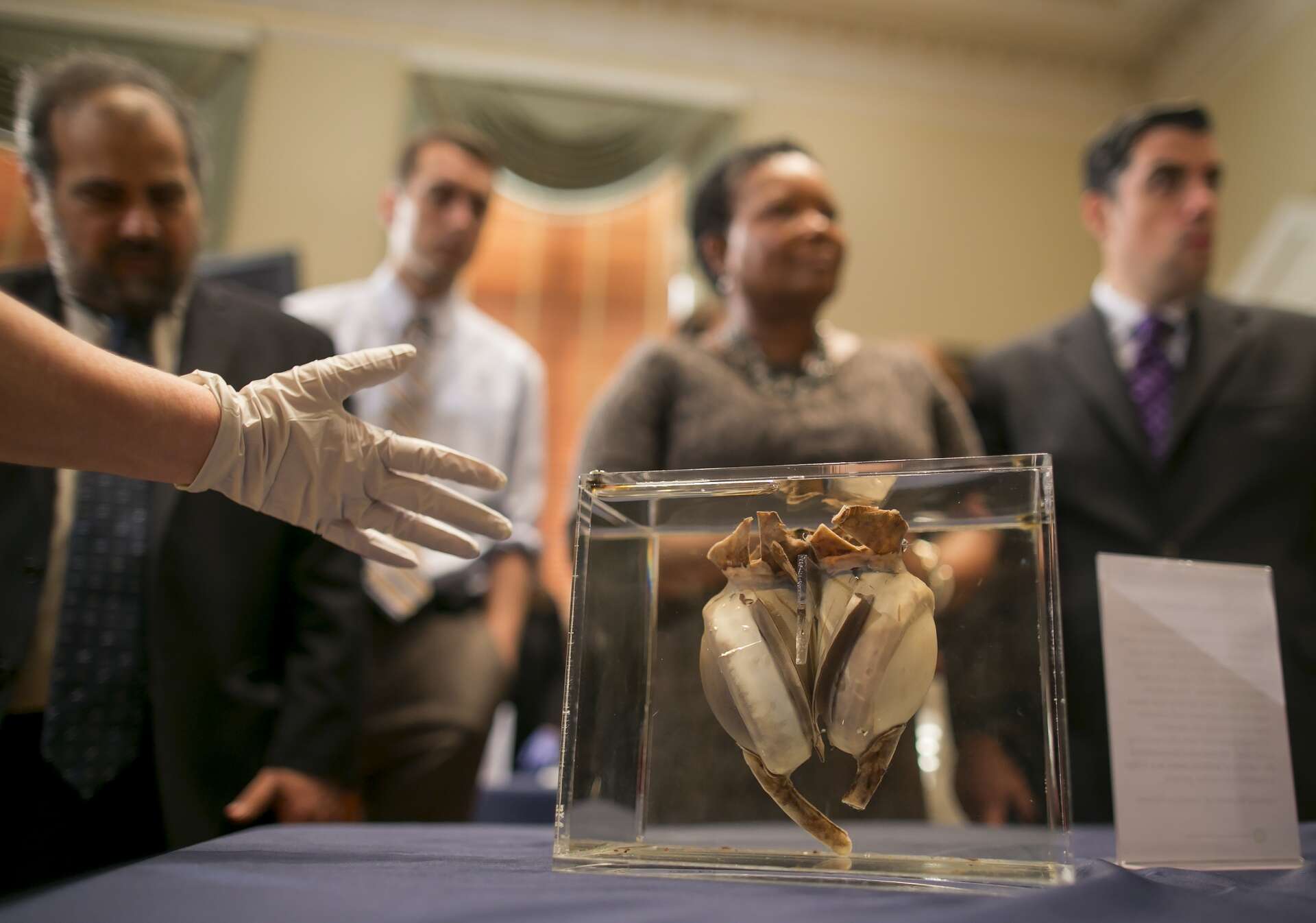 World's first artificial heart displayed after nearly 50 years at ...