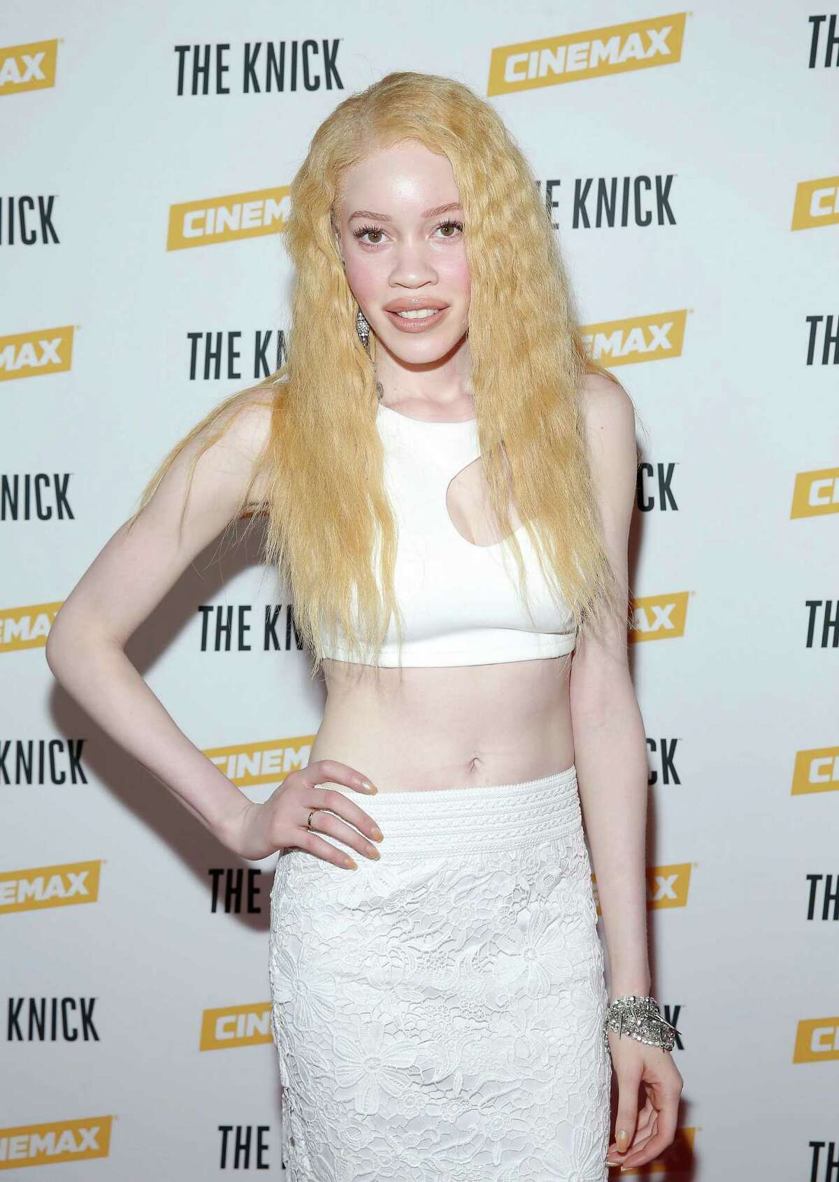 Supermodel who championed body confidence responds to body shaming rumors