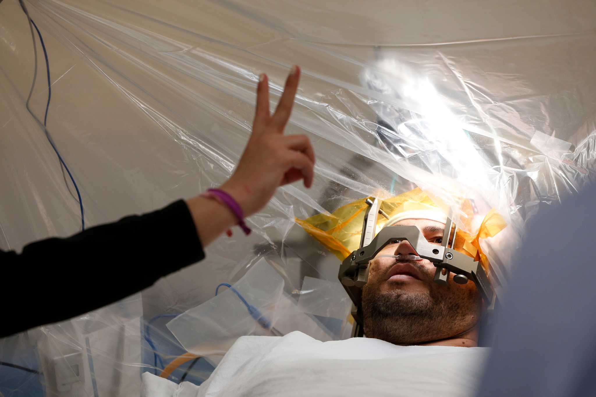 Doctors try deep brain stimulation to treat chronic depression