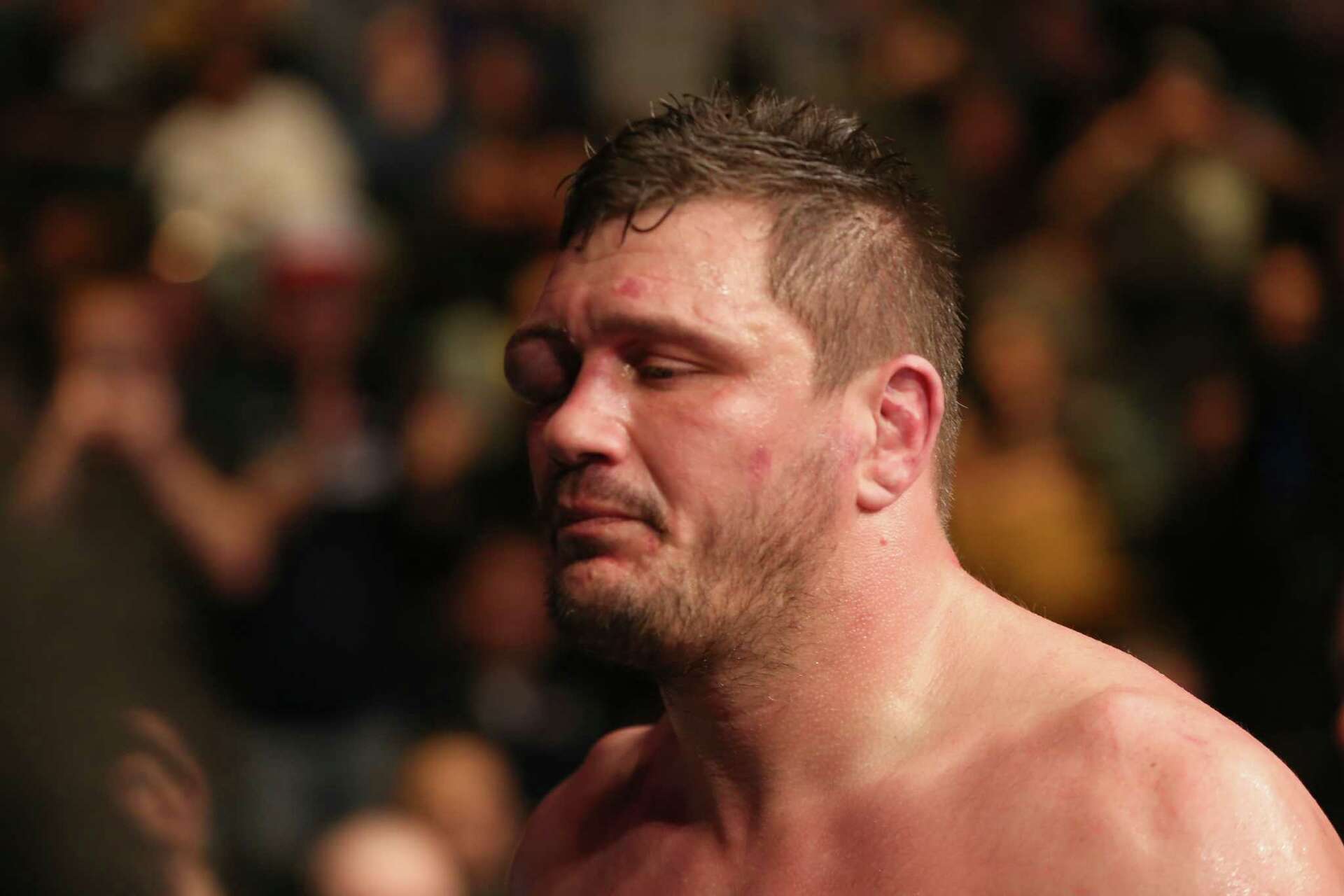UFC fighter's gruesome eye injury still looks awful three days later