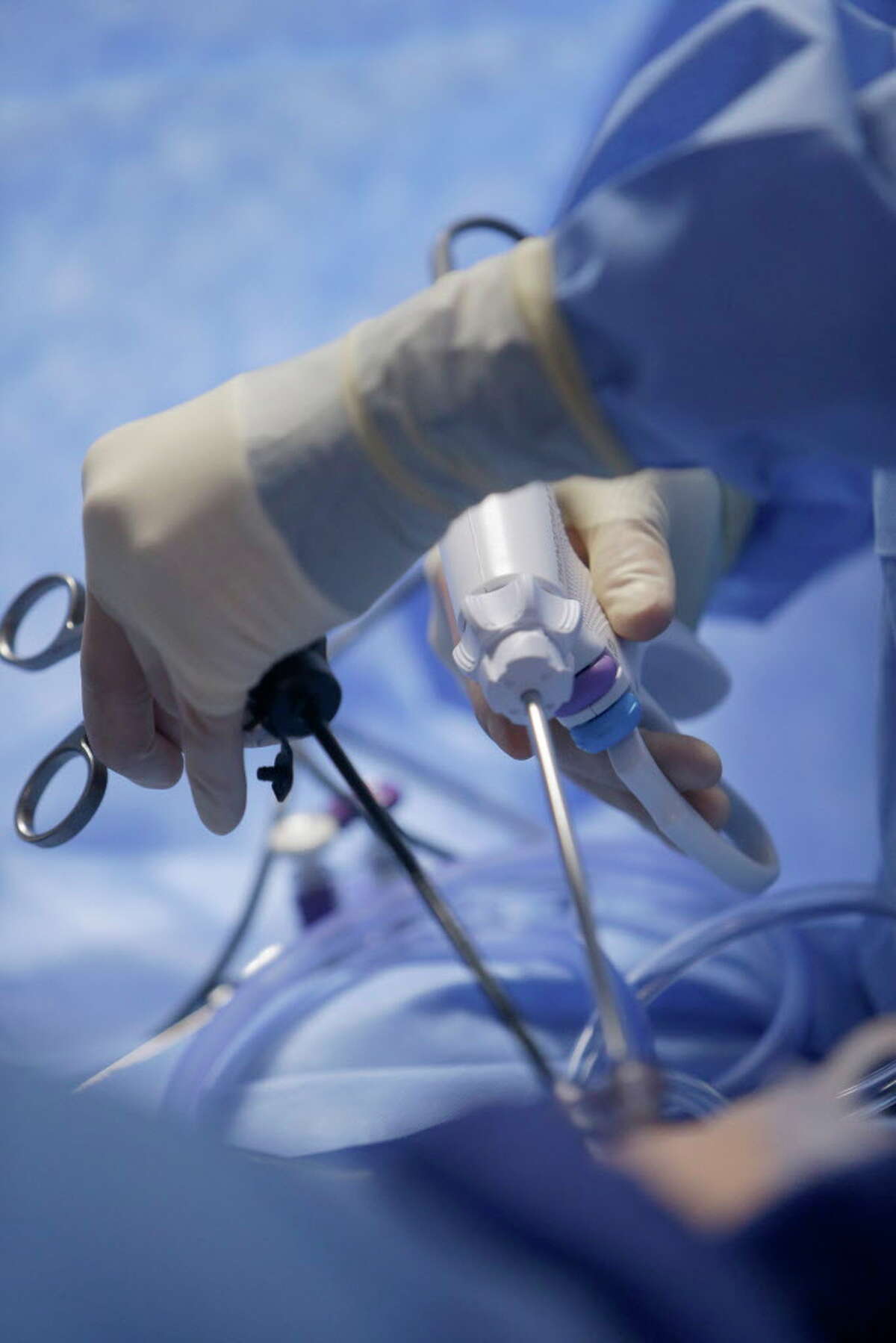 3-D imaging could benefit laparoscopic surgery