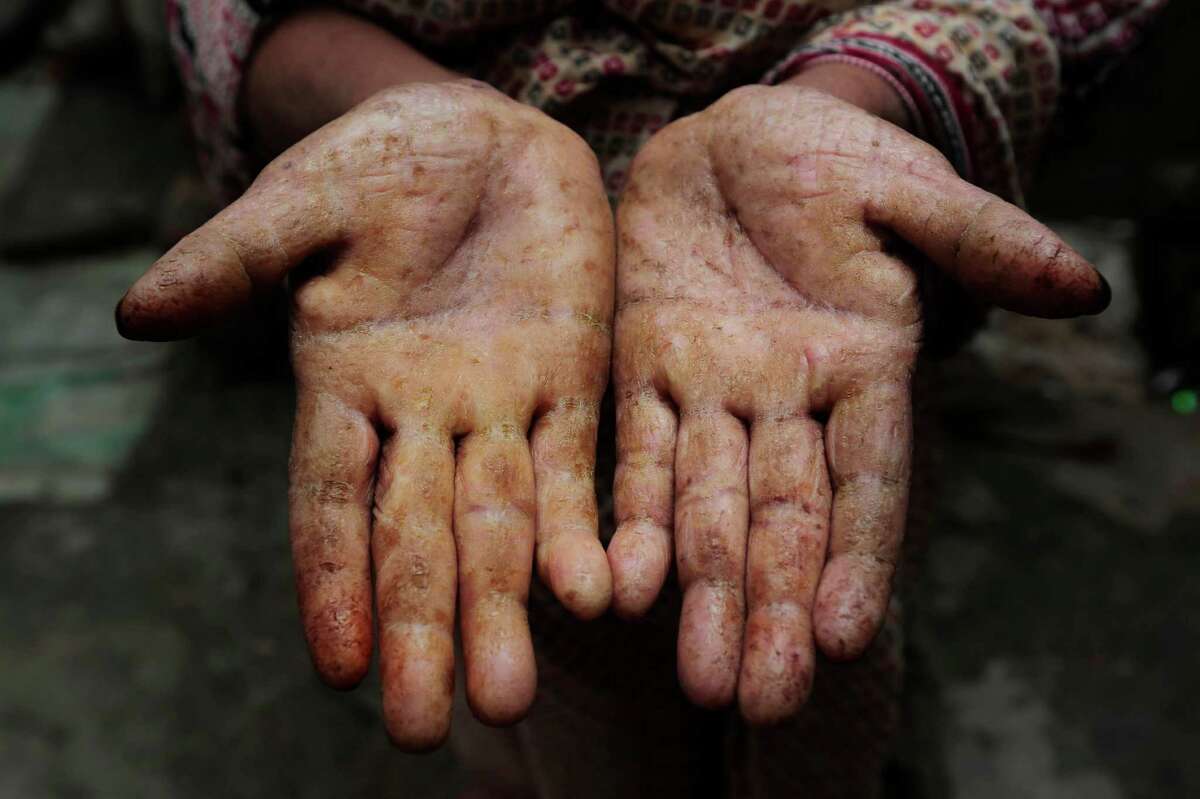 Bangladesh failing to spare millions from arsenic poisoning