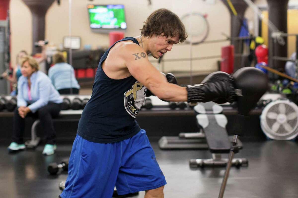 Chimp attack victim survived with bionic — and human — help