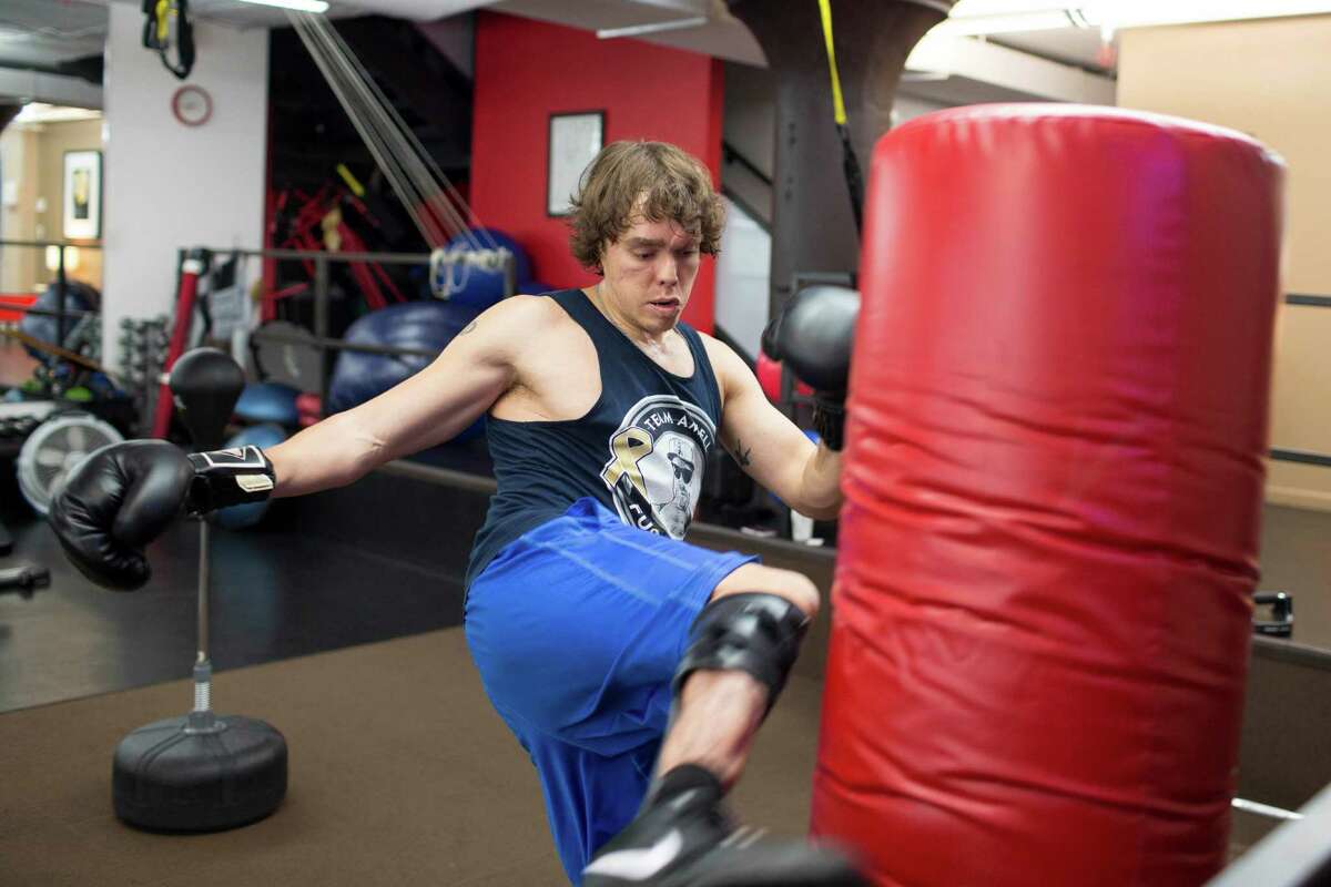 Chimp attack victim survived with bionic — and human — help