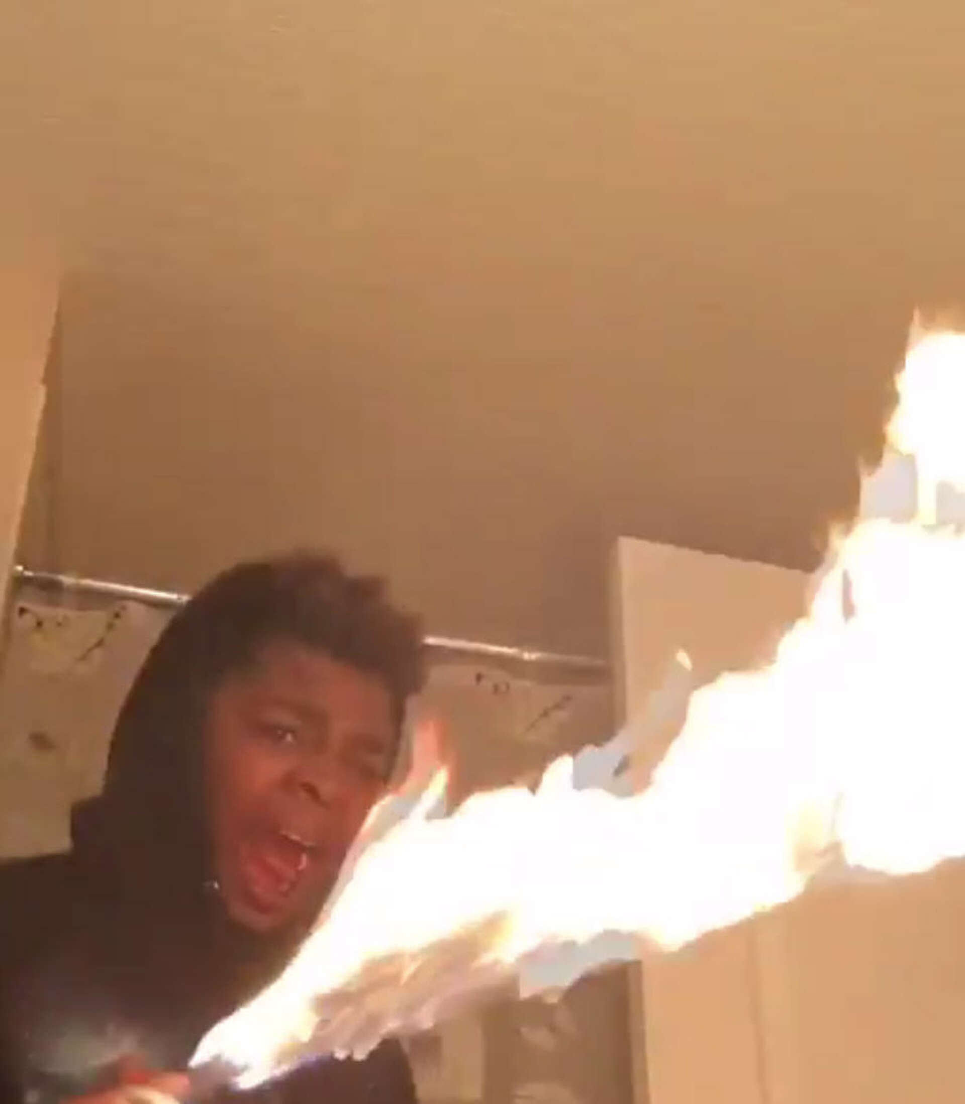 Boy, 14, burned playing 'Fire Challenge' game