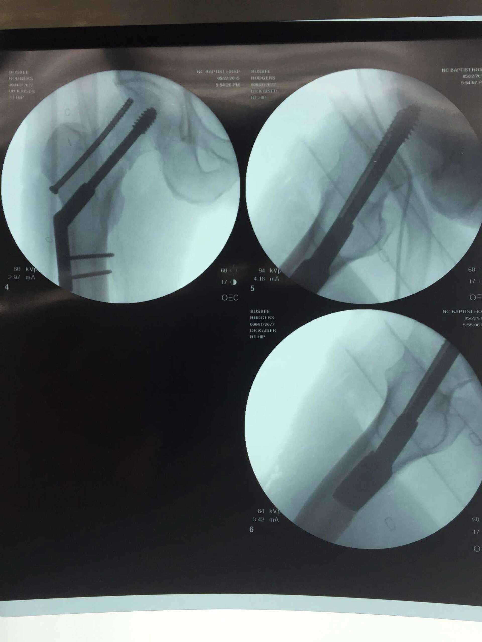 Marathoner’s recovery inspires surgeon to start a running routine