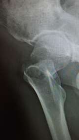 Marathoner’s recovery inspires surgeon to start a running routine