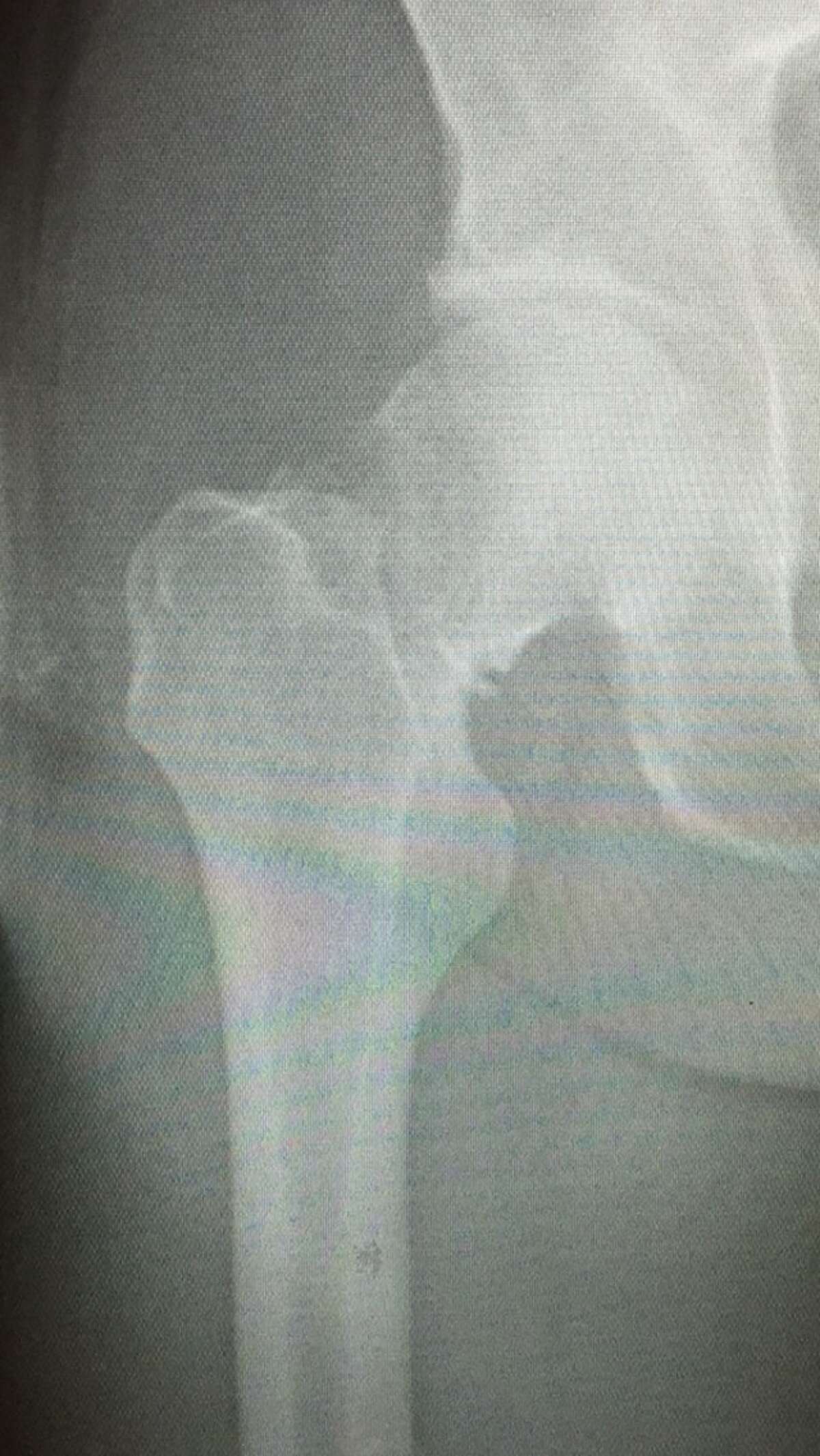 Marathoner’s recovery inspires surgeon to start a running routine