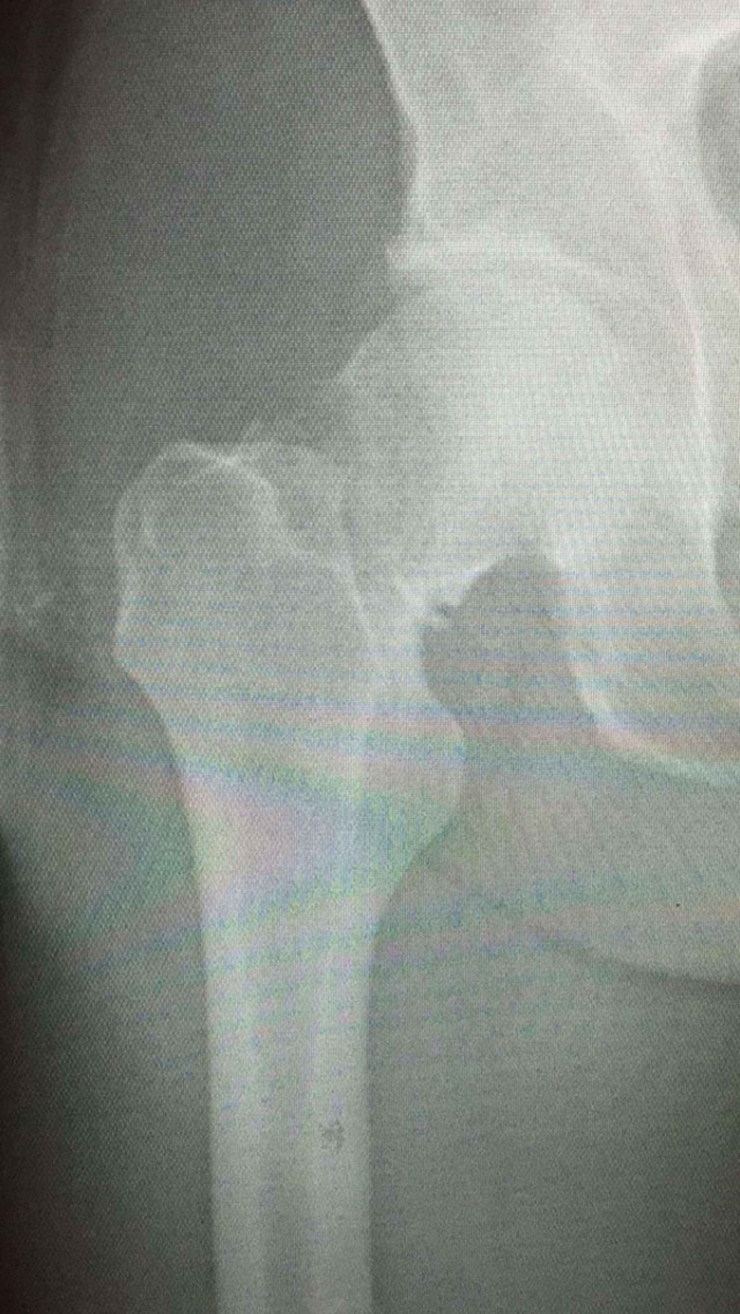 Marathoner’s recovery inspires surgeon to start a running routine