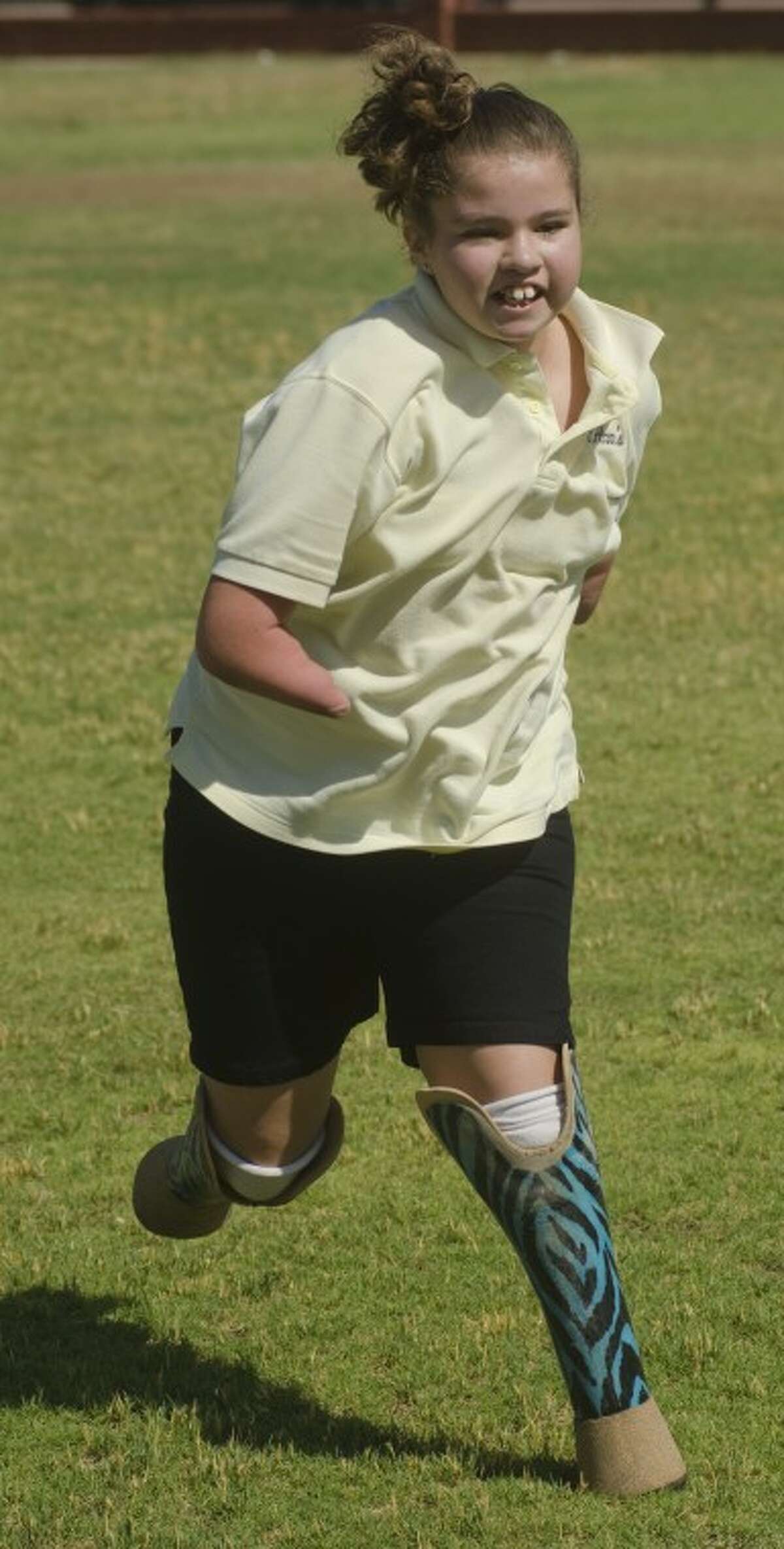 Girl born without hands and feet to compete today in track meet