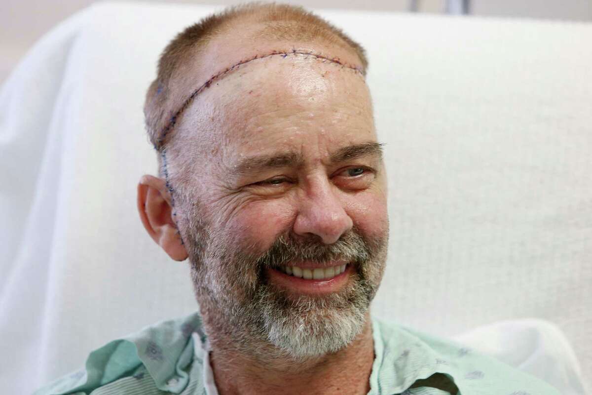 World's first skull-scalp transplant patient returns to Houston fully ...