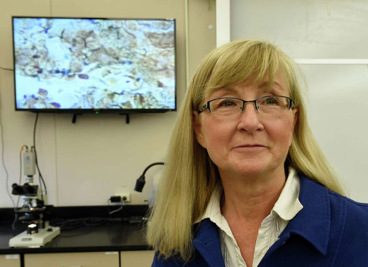 No cure for Lyme disease treatment debate