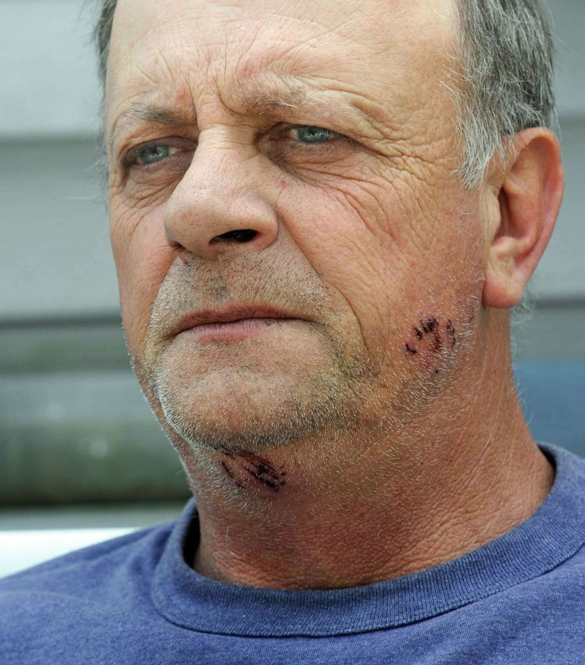 German shepherds attack Ridgefield man and pup on stroll