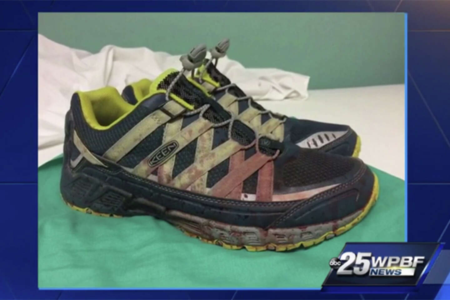 Orlando doctor's blood-stained shoes go viral