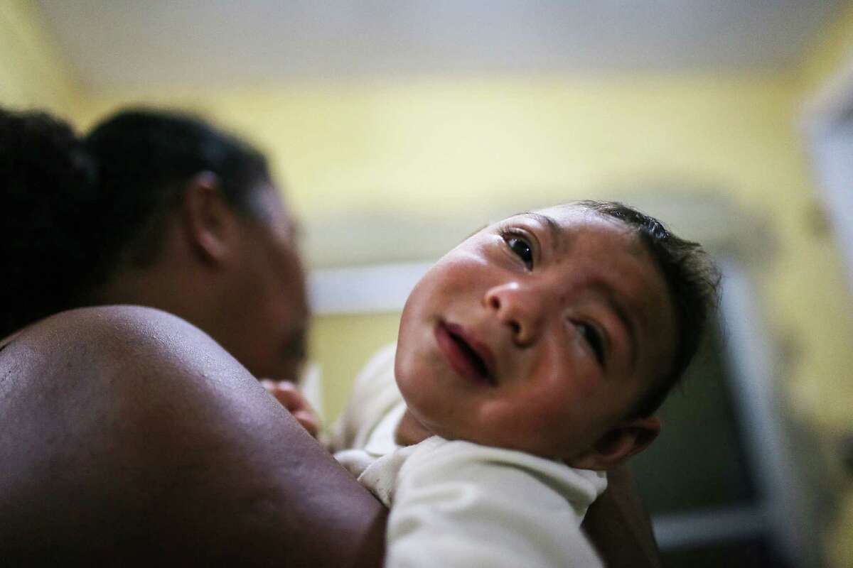 Zika harming more Brazilian babies than expected
