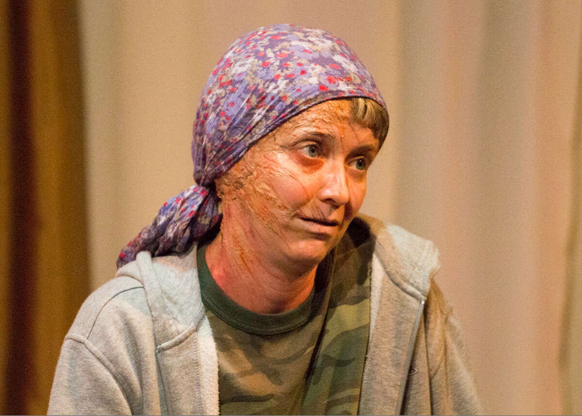 'Ugly Lies the Bone' offers searing drama on pain, recovery