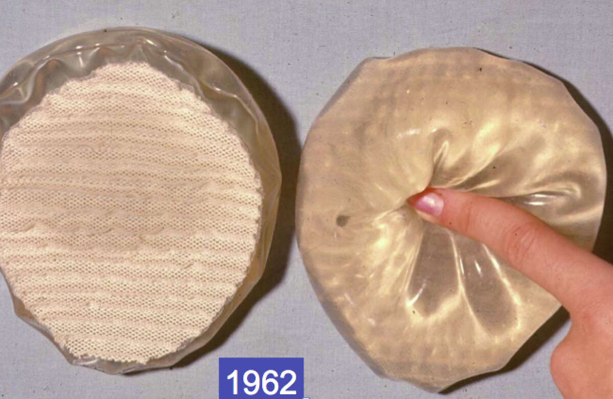 Invention made Houston global hub for breast implants