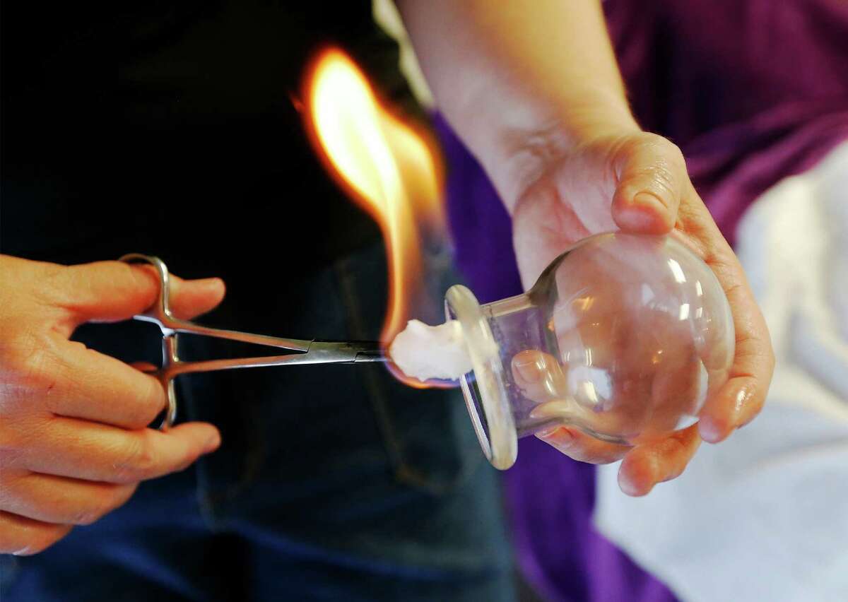 Olympic athletes start trend with visible cupping bruises