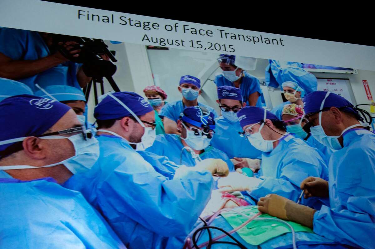 Photos: Firefighter Patrick Hardison, world's 1st face transplant ...