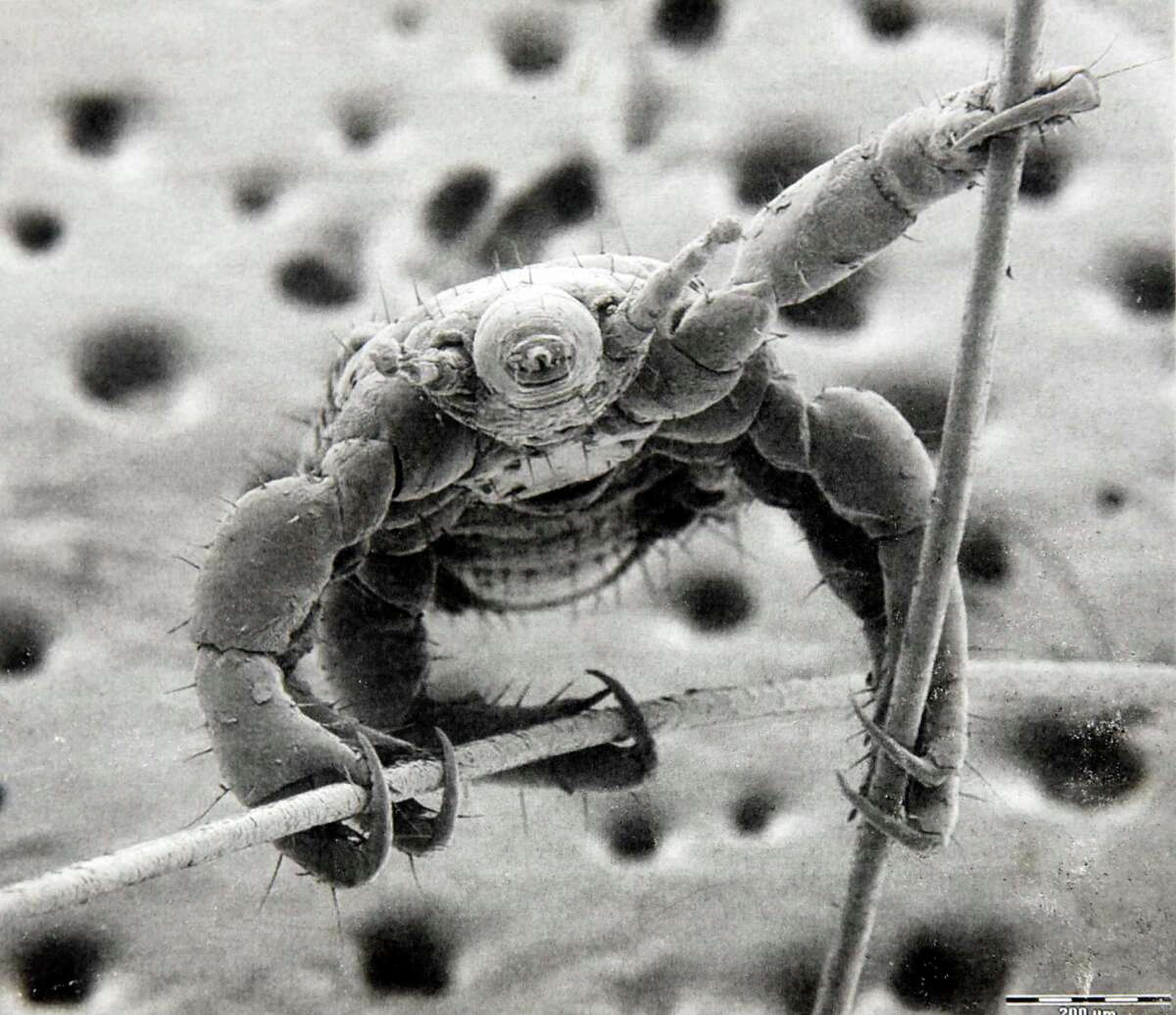 'Super lice' evade treatment with common remedies