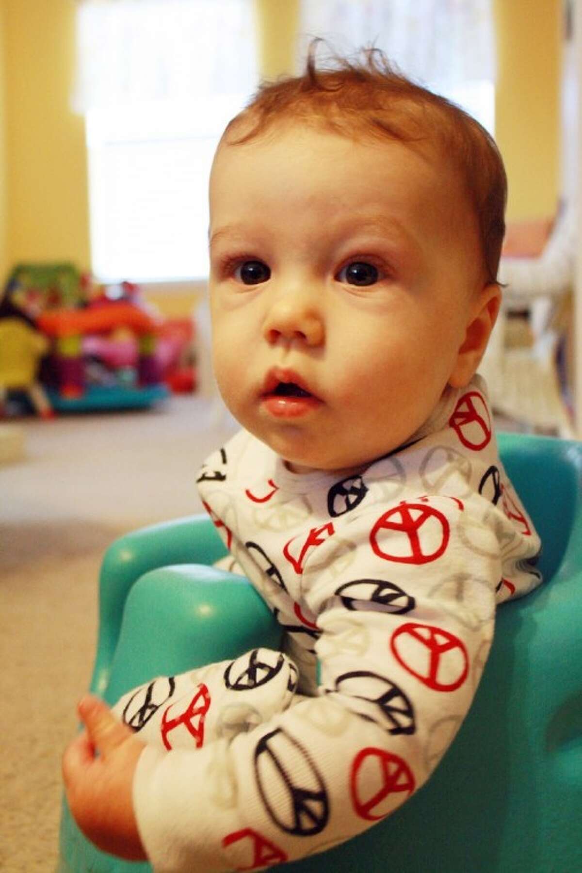 Fundraiser set for 7-month-old born with missing limbs