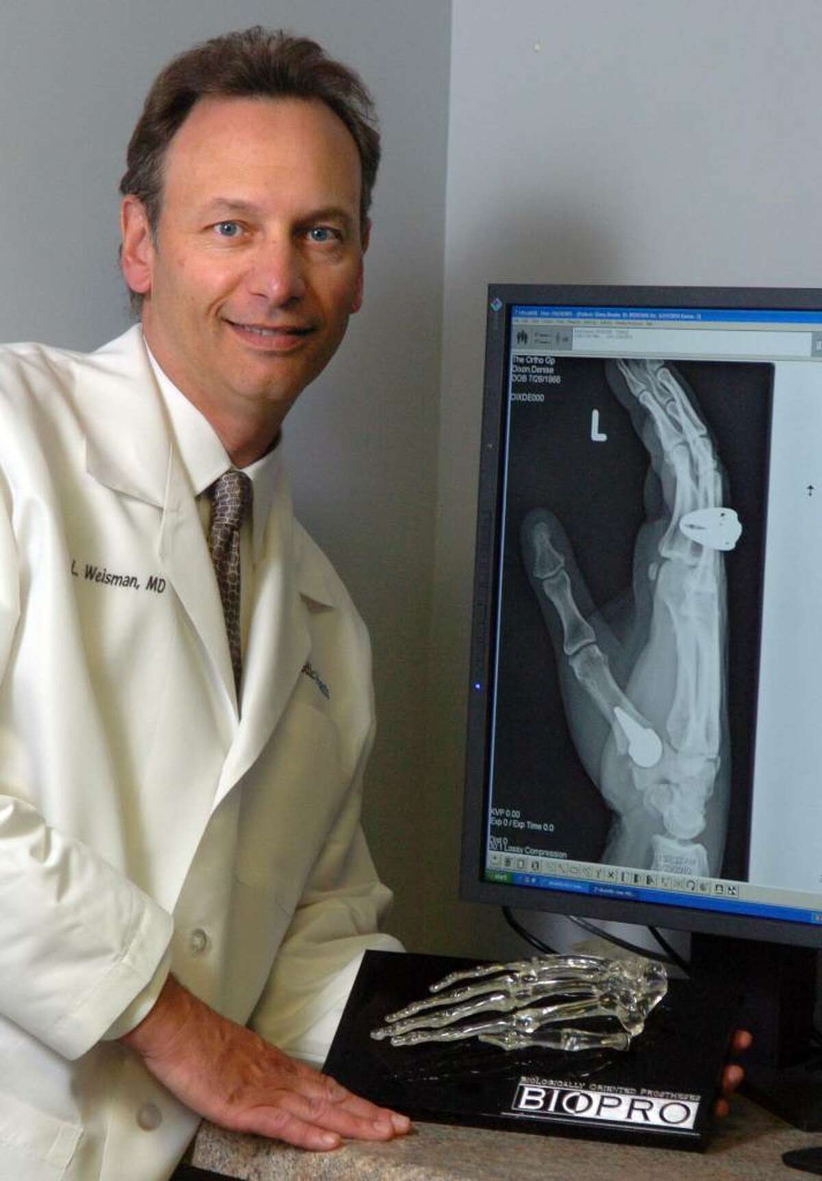 Not all thumbs: Milford doctor is first in state to offer joint ...