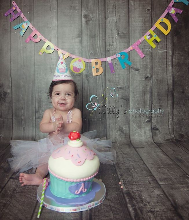 Baby born with heart outside body celebrates first birthday
