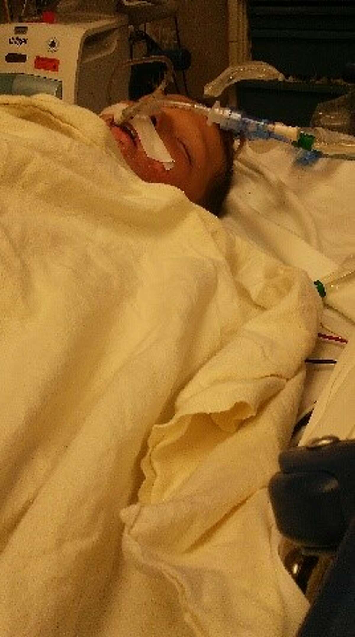 Assault charge added in case of severely burned Kerrville boy