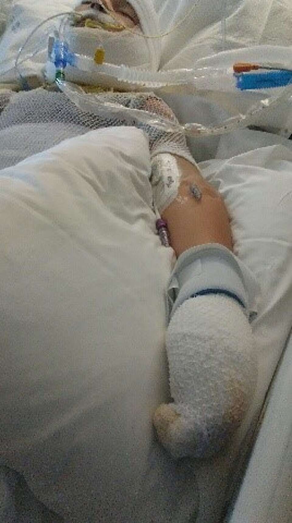 10-year-old Kerrville boy in a coma after suffering severe burns