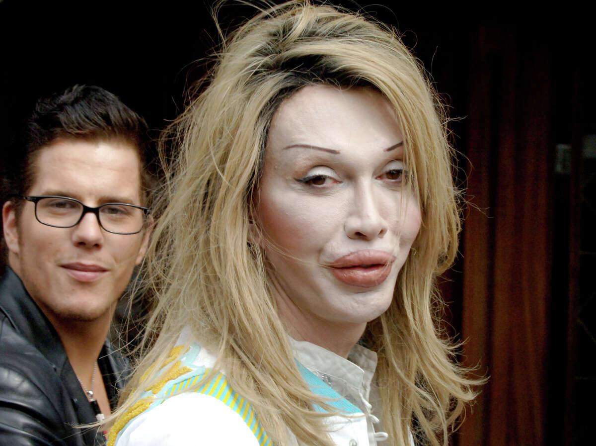 Pete Burns of Dead or Alive embodied glam lifestyle of the '80s, was a ...