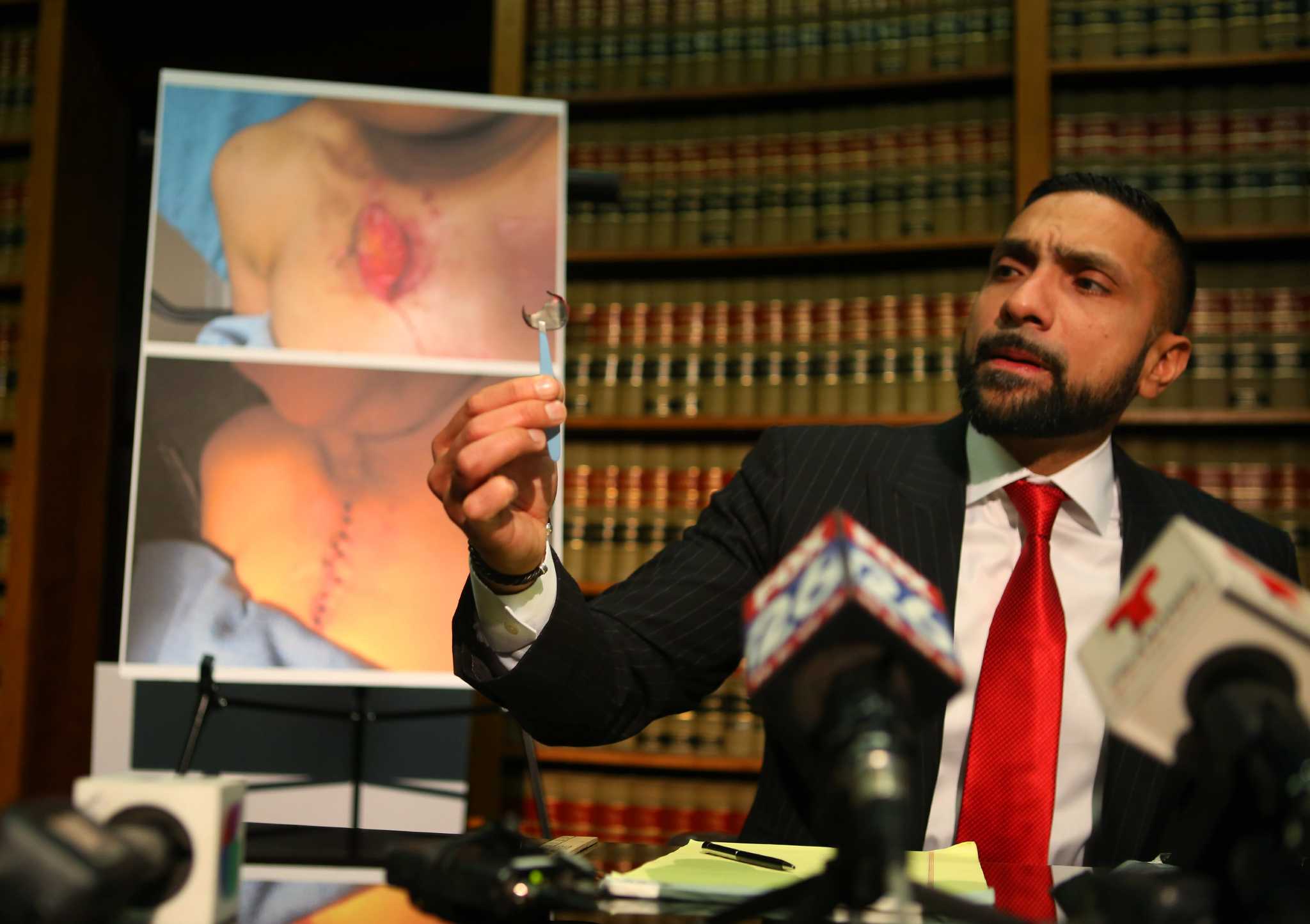 Cinco Ranch woman sues Takata, Honda over air bag injury