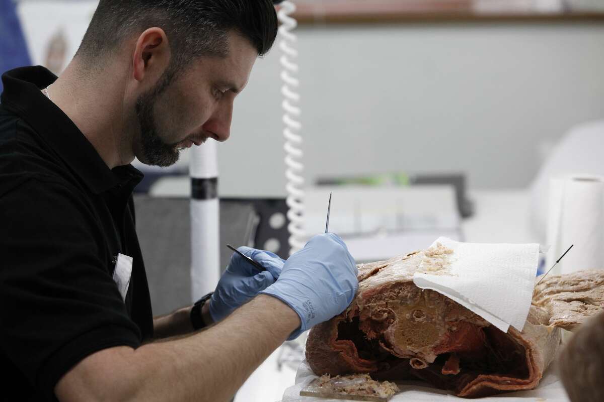 Eye-popping Body Worlds RX exhibit coming to Houston for four-month run