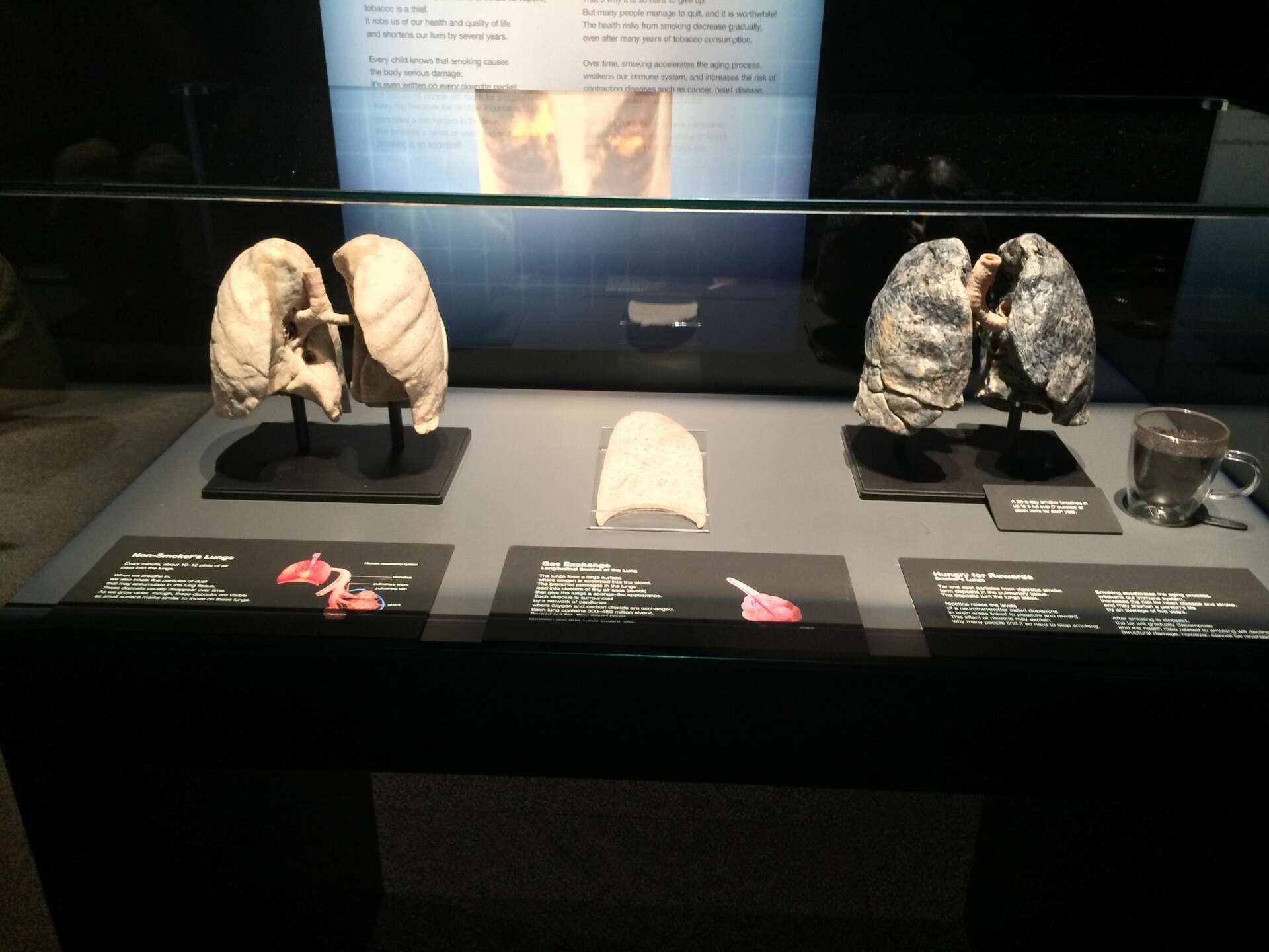 Eye-popping Body Worlds RX exhibit coming to Houston for four-month run