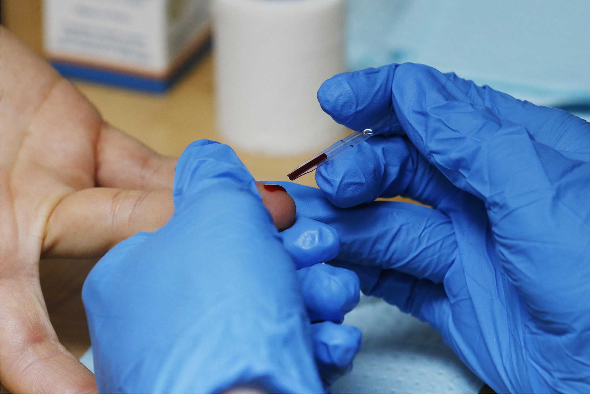 Chlamydia Gonorrhea Rates Reach Record Highs In Bexar County Chlamydia Gonorrhea Rates Reach Record Highs In Bexar County