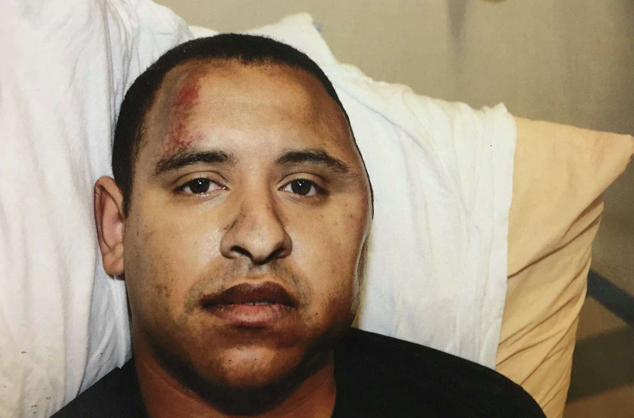 Schenectady cop recalls brutal attack in student address