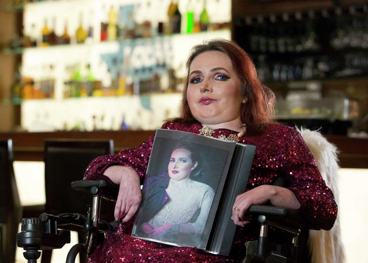 Local champion for models with disabilities dies