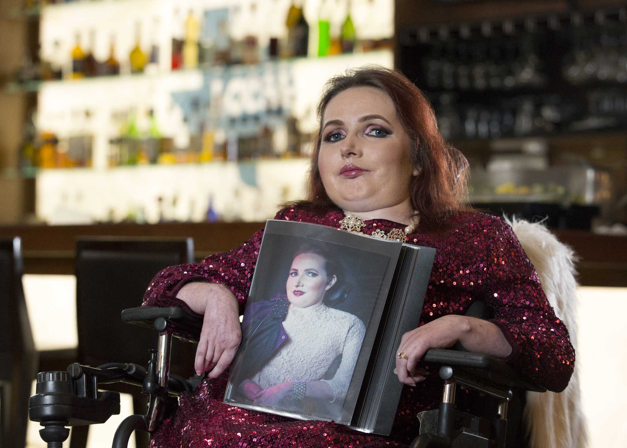 Local champion for models with disabilities dies