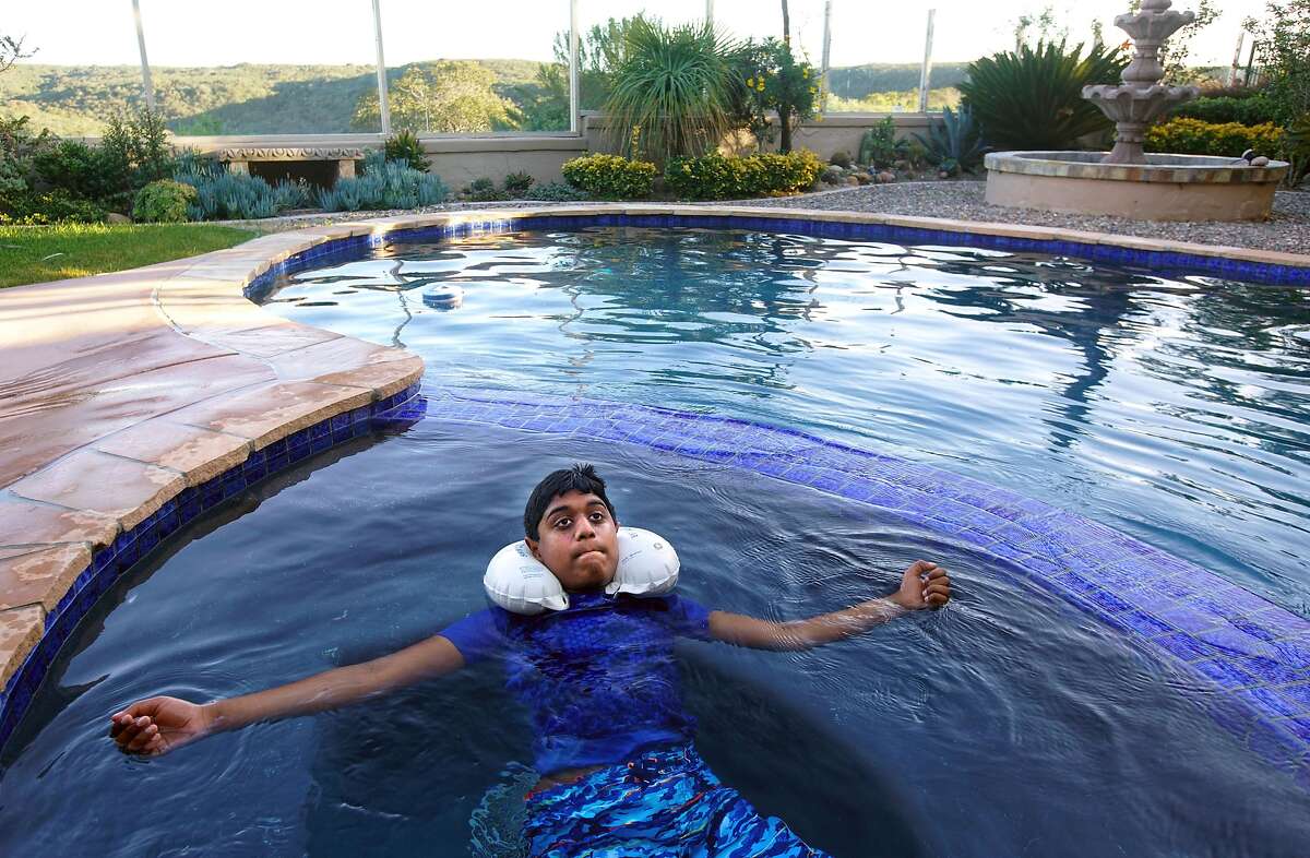 Science closing in on polio-like virus that paralyzed children