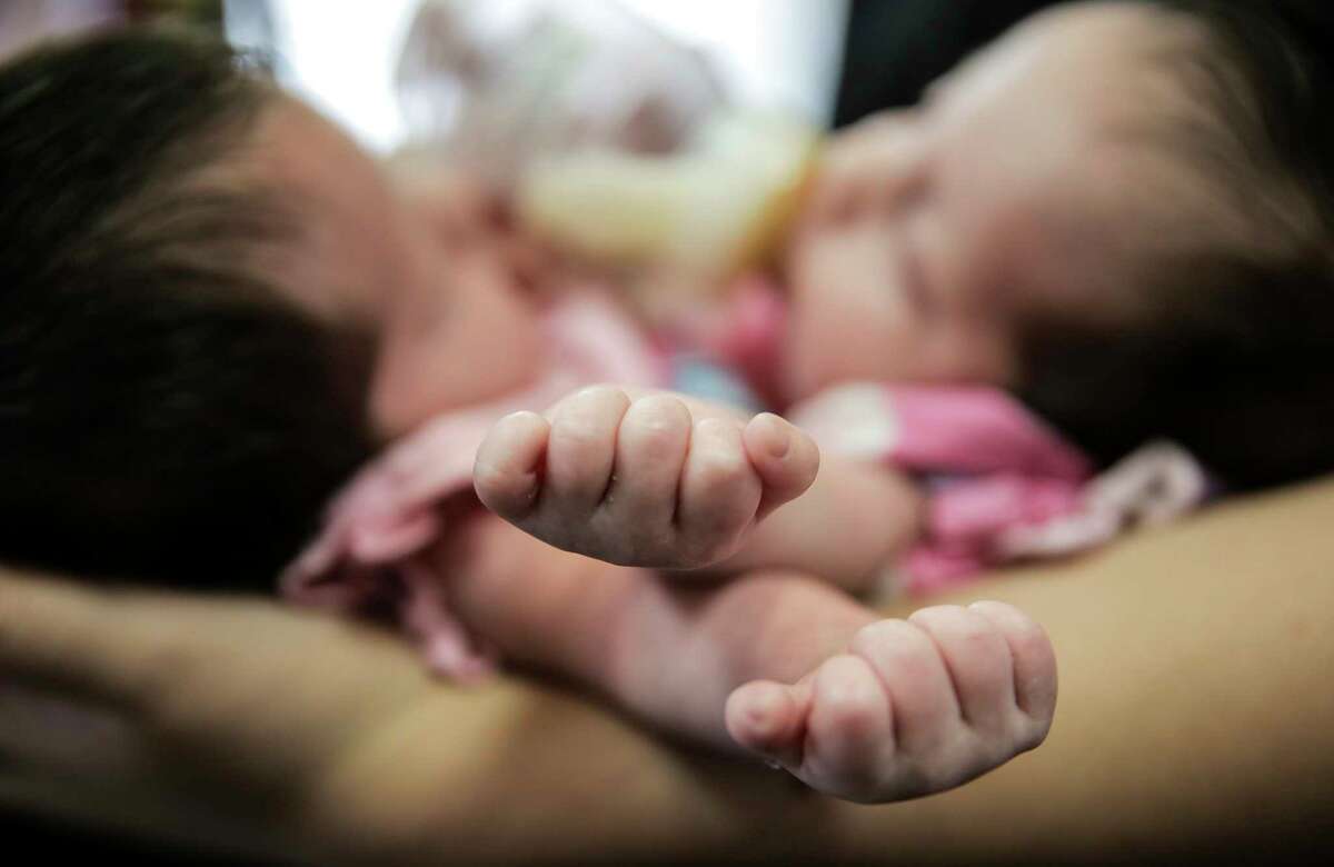 Parents came to Houston to save conjoined twins; now, it's time to go home