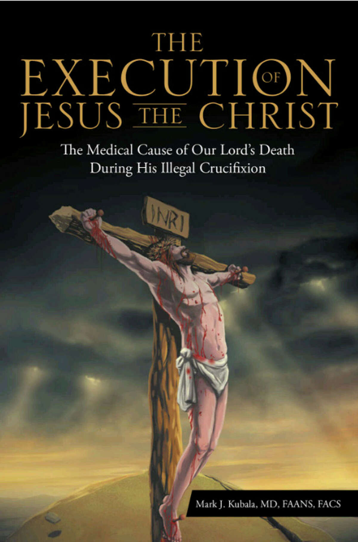 Beaumont doctor explains forensics behind Jesus' crucifixion