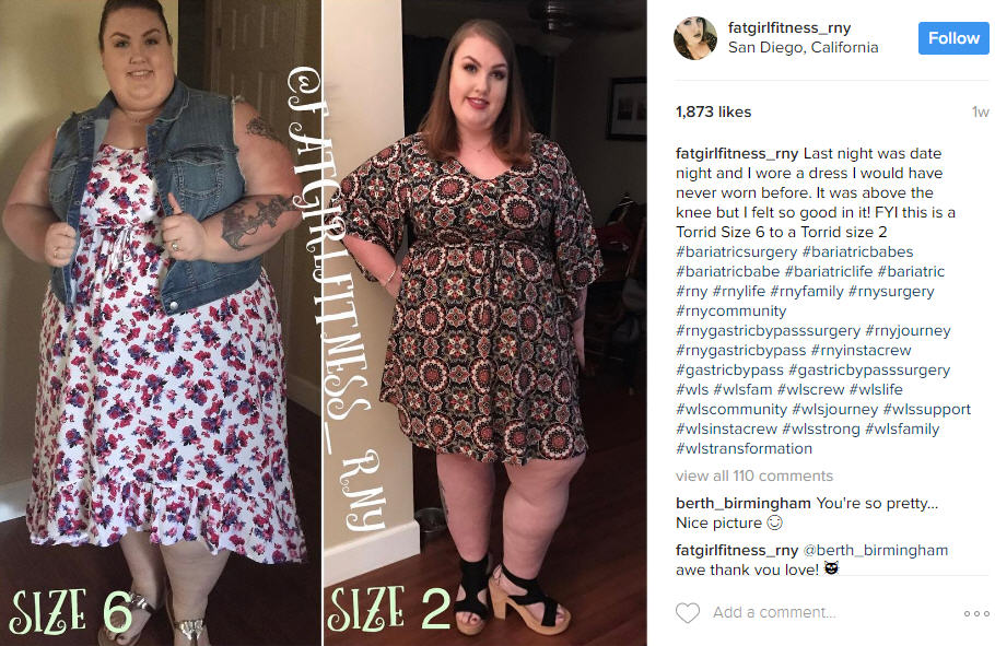 California woman sheds over 170 pounds; her body and face dramatically ...